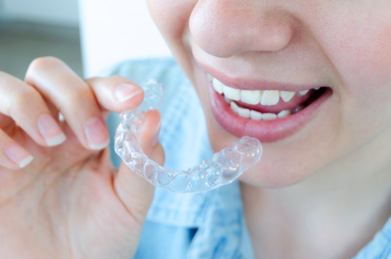 Out of Order: What to Do If Your Invisalign Aligner Doesn’t Fit ...